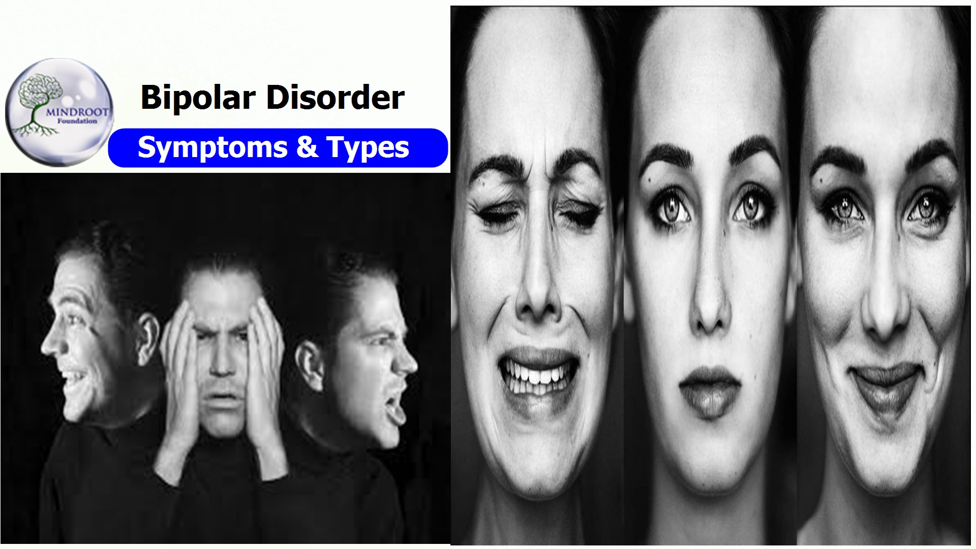 About Bipolar Disorder Symptoms Types Treatment